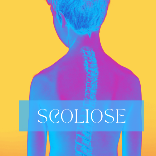 Comprendre la scoliose | Endorphine Massothérapie